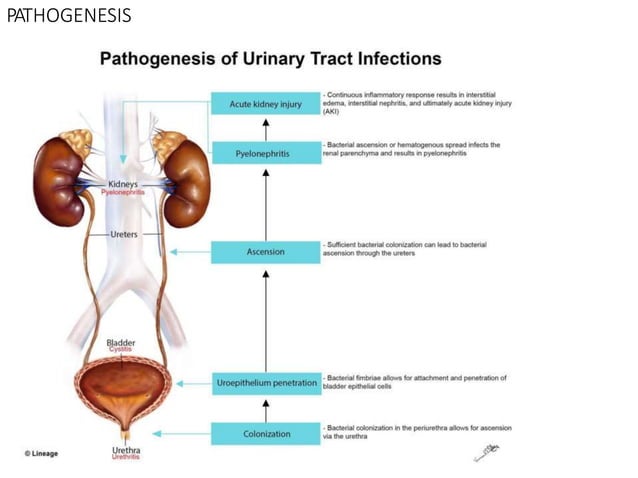 DRUGS USED FOR UTI.pptx | Infectious Diseases | Diseases and Conditions