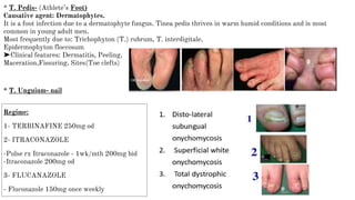 Drugs used in fungal infection | PPT