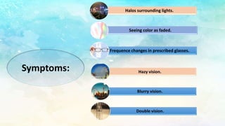 Drugs used in ocular pharmacology | PPTX