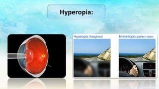 Drugs used in ocular pharmacology | PPTX