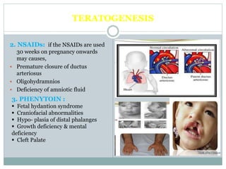 Drug therapy in pregnancy and lactation | PPTX