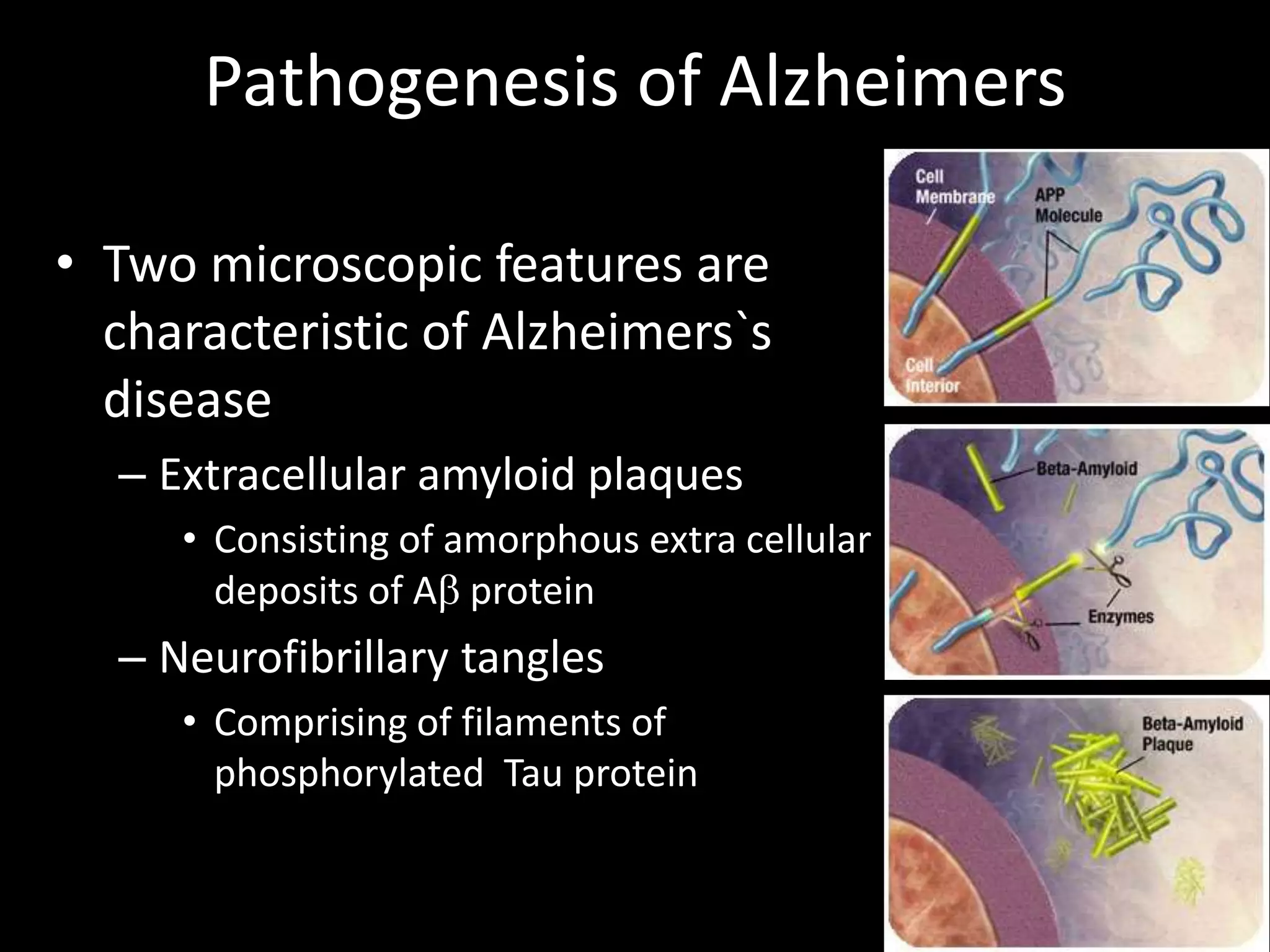 Drug treatment of alzheimers disease | PPTX