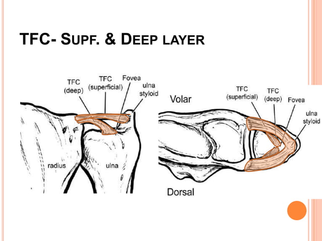 Druj and tfcc injuries f | PPTX | Death, Injury, or Military Conflict | Sensitive Topics