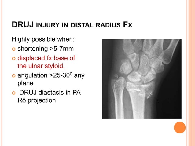 Druj and tfcc injuries f | PPTX | Death, Injury, or Military Conflict | Sensitive Topics
