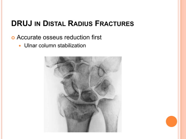Druj and tfcc injuries f | PPTX | Death, Injury, or Military Conflict ...