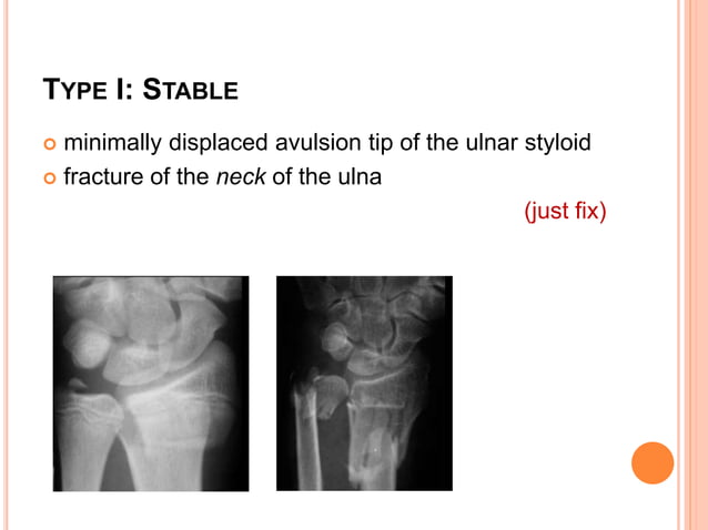 Druj and tfcc injuries f | PPTX | Death, Injury, or Military Conflict | Sensitive Topics