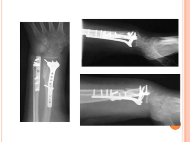 Druj and tfcc injuries f | PPTX | Death, Injury, or Military Conflict | Sensitive Topics