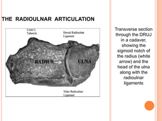 Druj and tfcc injuries f | PPT