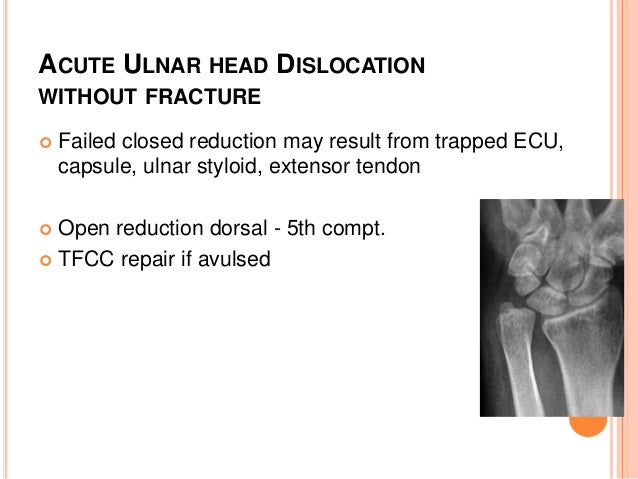 Druj and tfcc injuries f