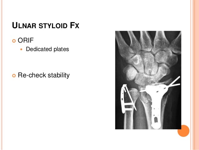 Druj and tfcc injuries f