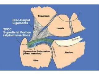 Distal Radioulnar Joint (DRUJ) Injuries | PPTX