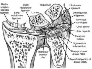 Distal Radioulnar Joint (DRUJ) Injuries | PPTX