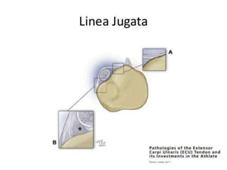Distal Radioulnar Joint (DRUJ) Injuries | PPTX