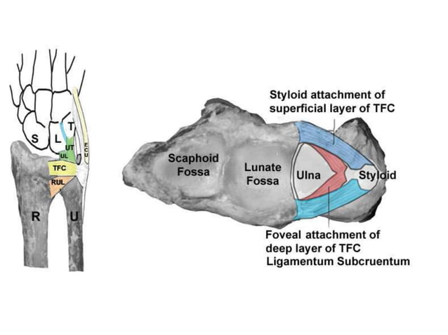 Distal Radioulnar Joint (DRUJ) Injuries | PPTX