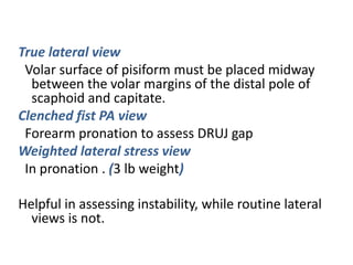Distal Radioulnar Joint (DRUJ) Injuries | PPTX