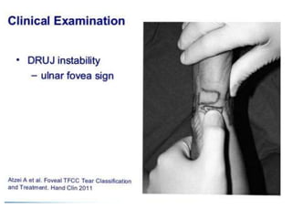 Distal Radioulnar Joint (DRUJ) Injuries | PPT