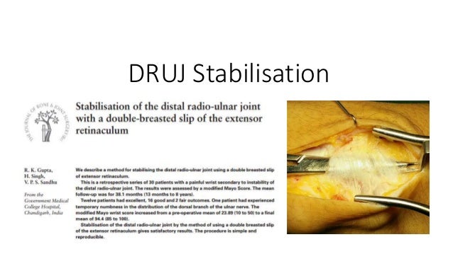 Druj stabilisation