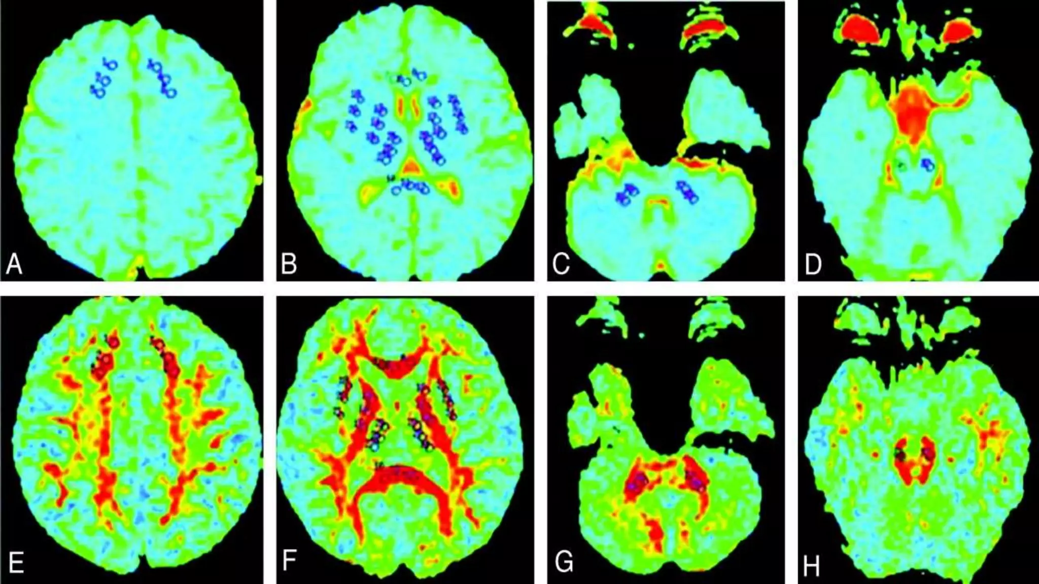 Science Journal - How alcohol work on brain & what is alcohol poisoning ...