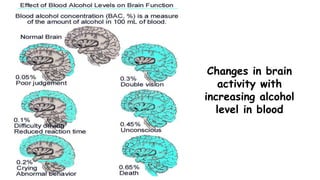 Science Journal - How alcohol work on brain & what is alcohol poisoning ...