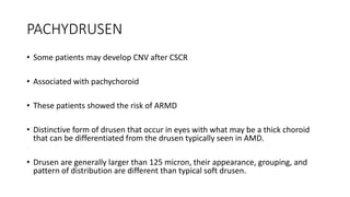 Drusen characterization | PPTX