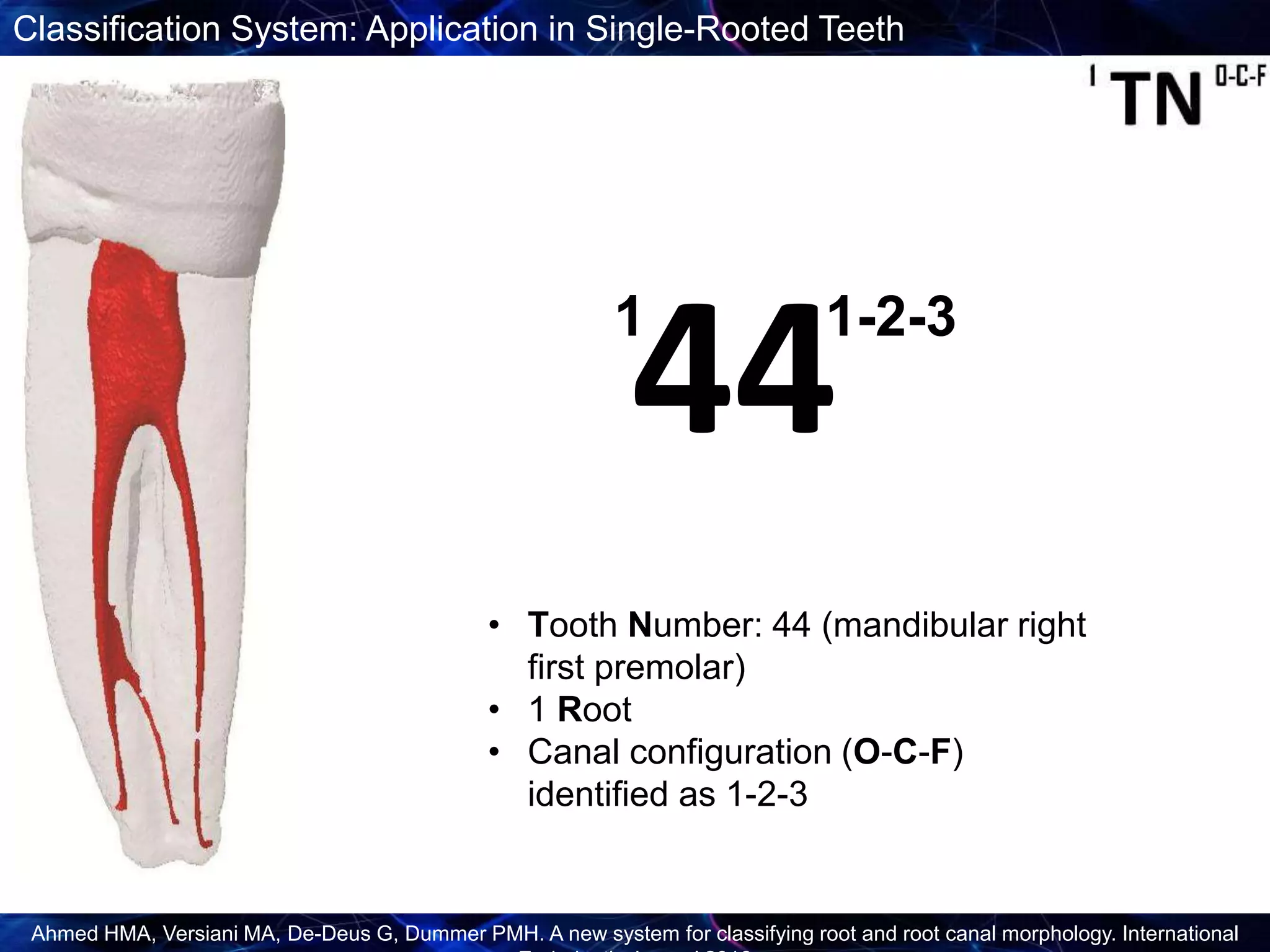 New Root Canal Classification System | PPTX