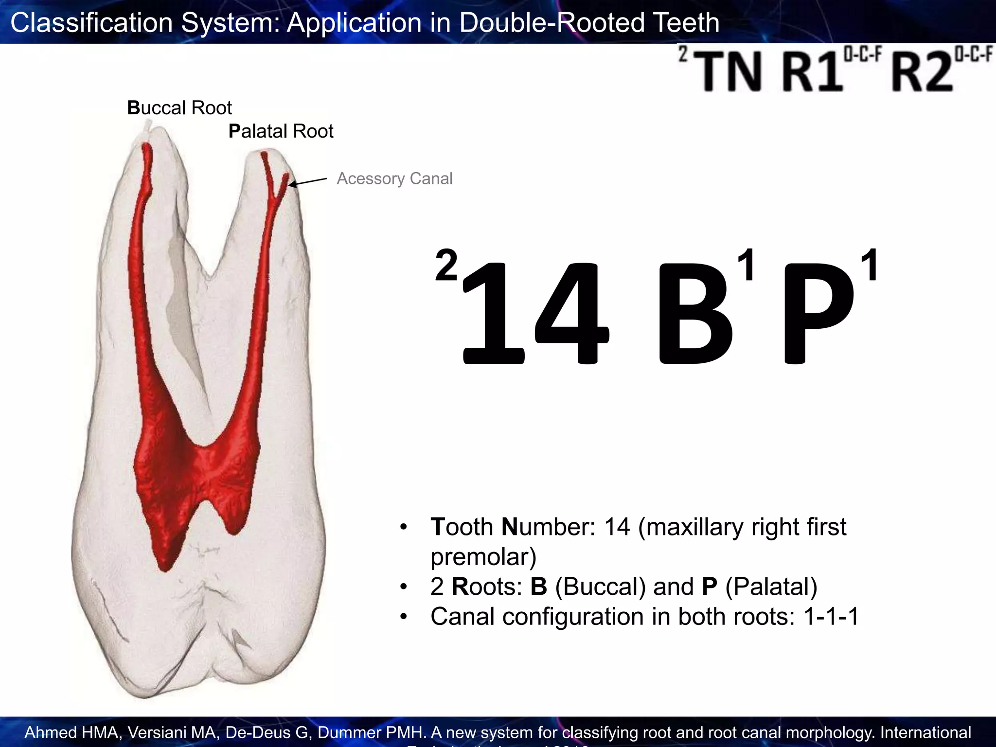 New Root Canal Classification System | PPTX