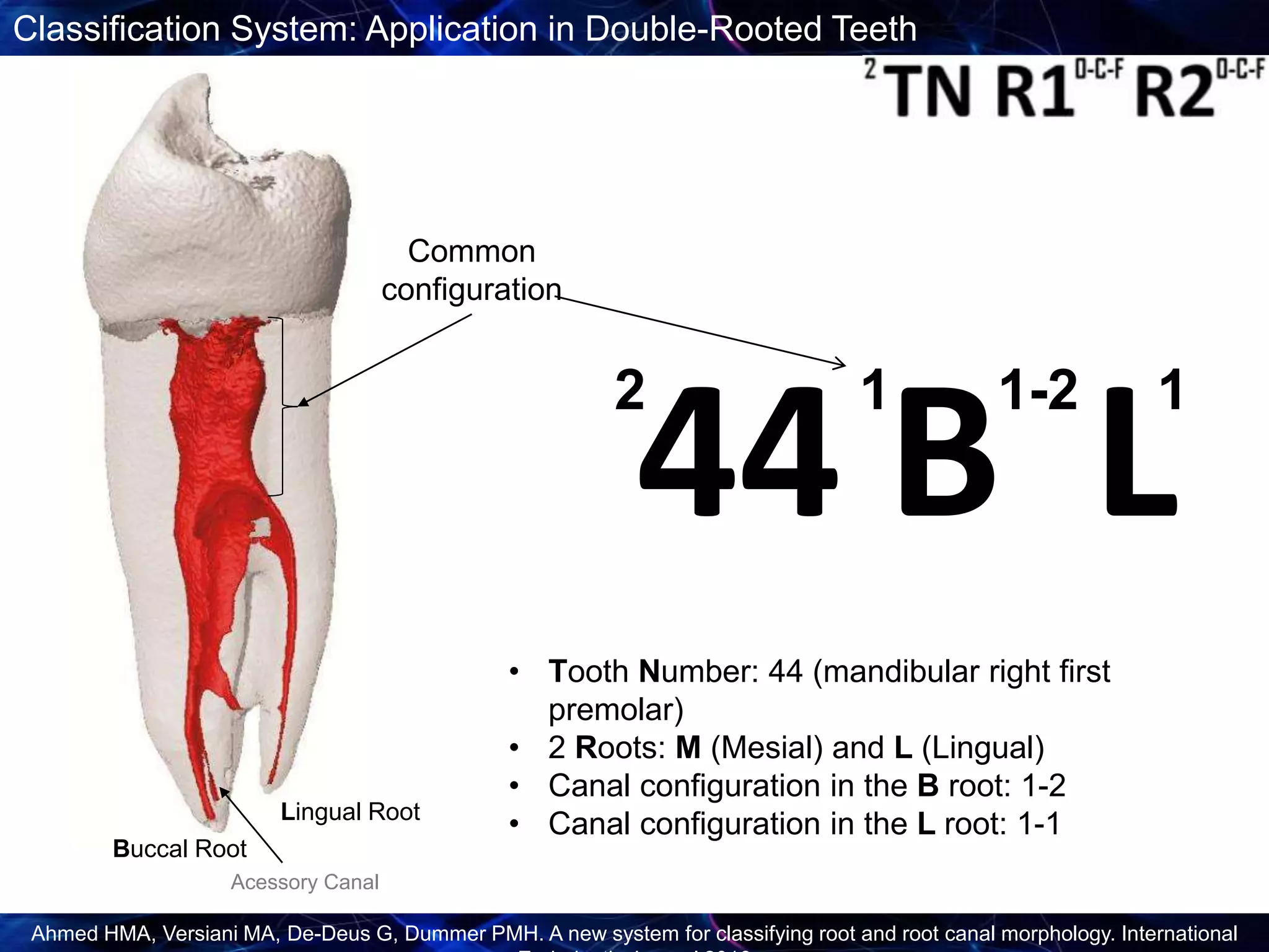 New Root Canal Classification System | PPTX