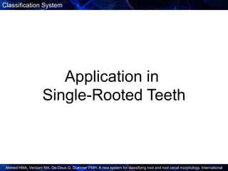 New Root Canal Classification System | PPTX