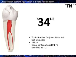 New Root Canal Classification System | PPTX