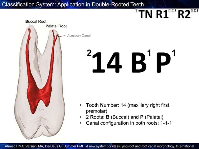 New Root Canal Classification System | PPTX