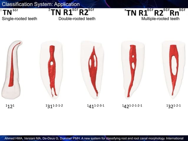 New Root Canal Classification System | PPT | Free Download