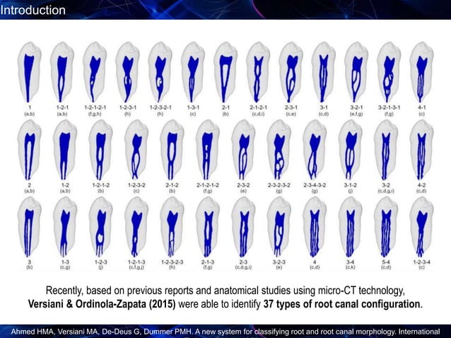 New Root Canal Classification System