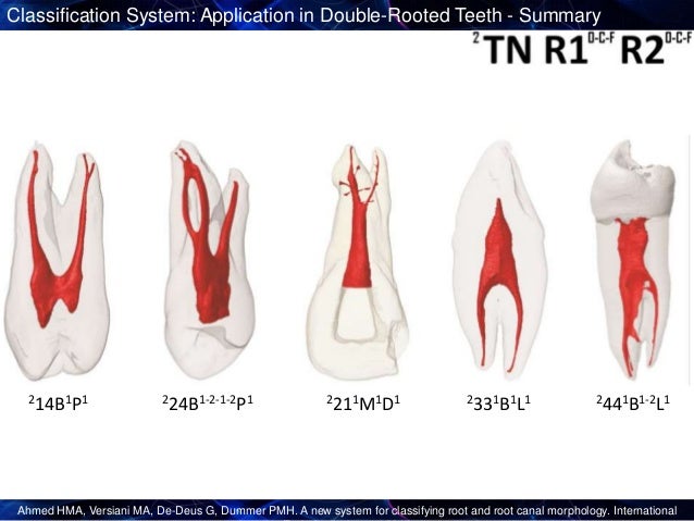 New Root Canal Classification System