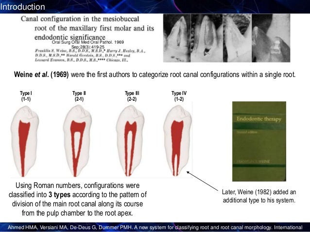 New Root Canal Classification System