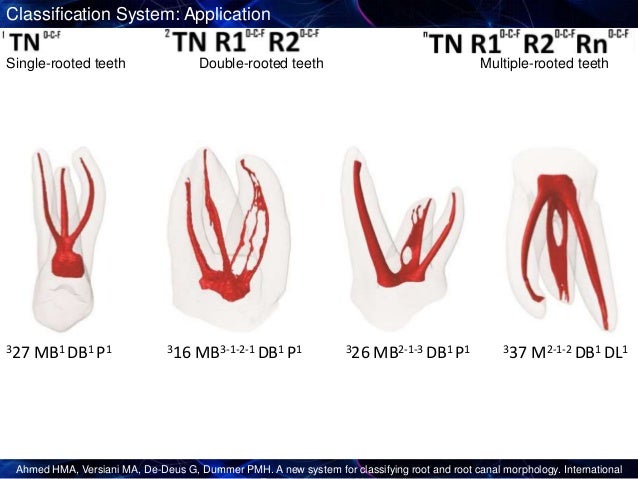 New Root Canal Classification System