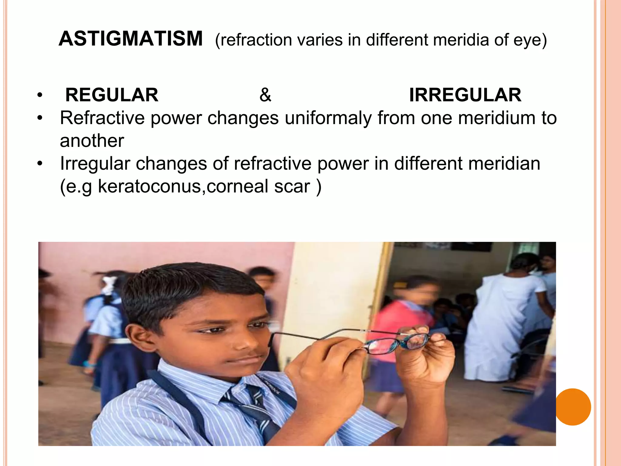 Dr vinit kumar paediatric refraction | PPTX