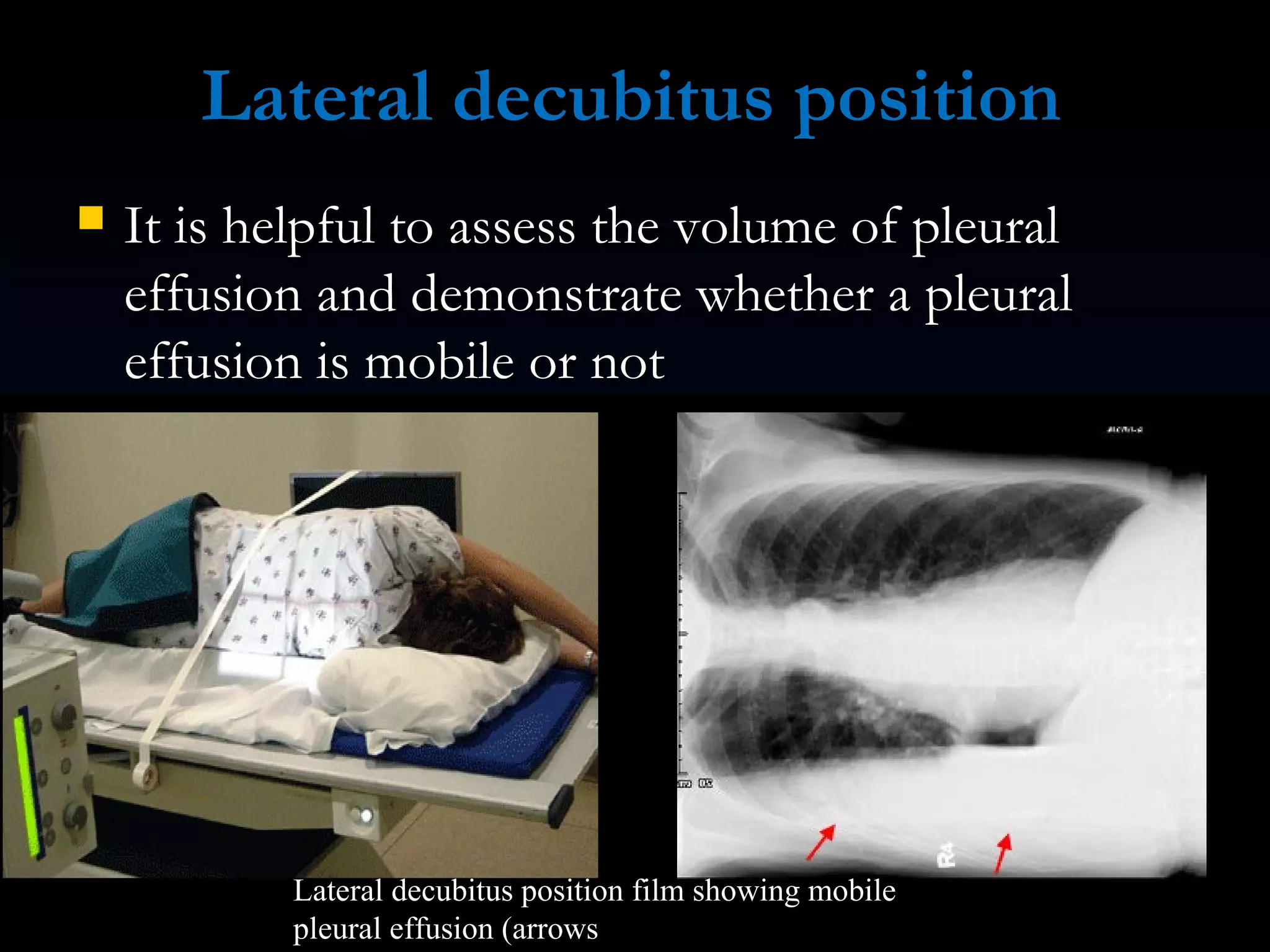 Dr vishnu x ray imaging | PPT