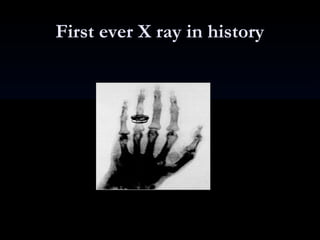 Dr vishnu x ray imaging | PPT