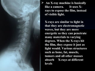Dr vishnu x ray imaging | PPT