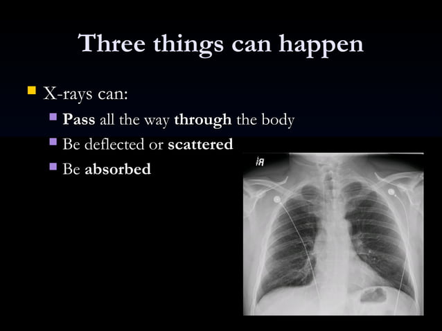 Dr vishnu x ray imaging | PPT