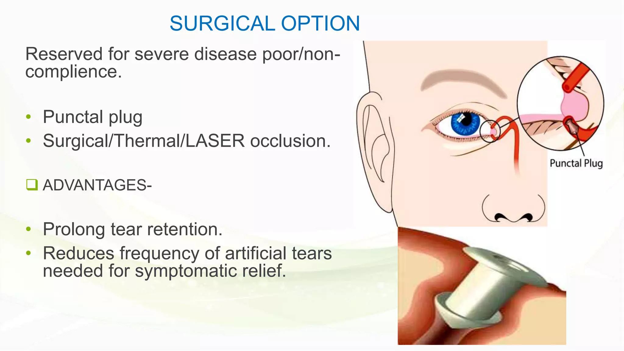 Dry eye management ppt | PPTX