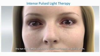 Dry eye management ppt | PPTX