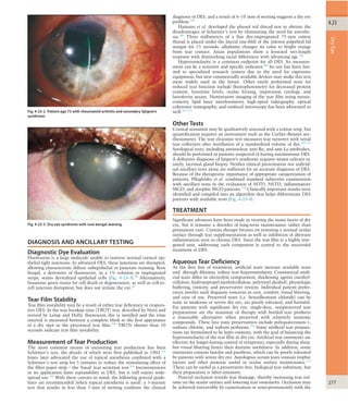Dry eye | PDF
