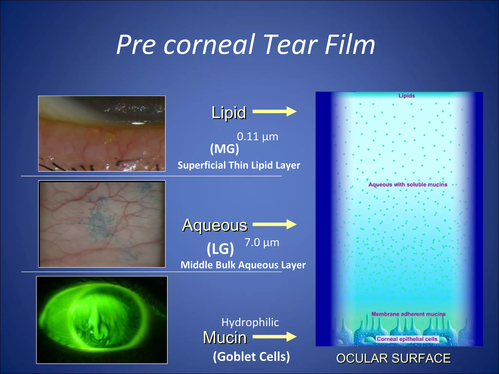 Dry eye | PPT
