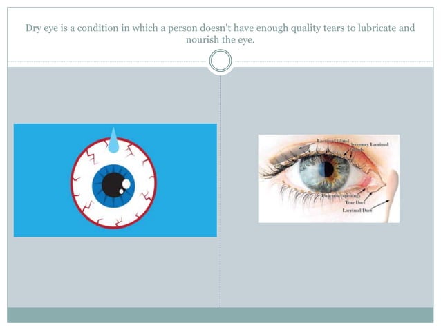 Dry eye | PPT