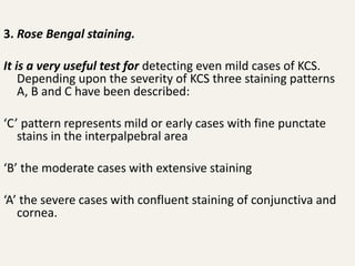 quick review on Dry eye | PPT