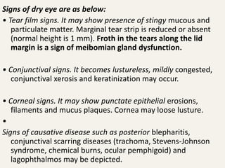 quick review on Dry eye | PPT