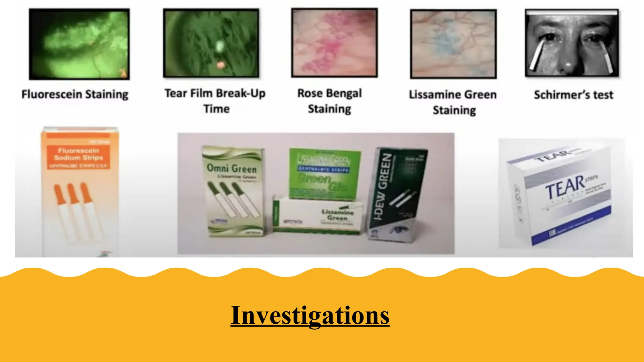 Dry Eye causes, aetiology, pathogenesis, treatment.pptx