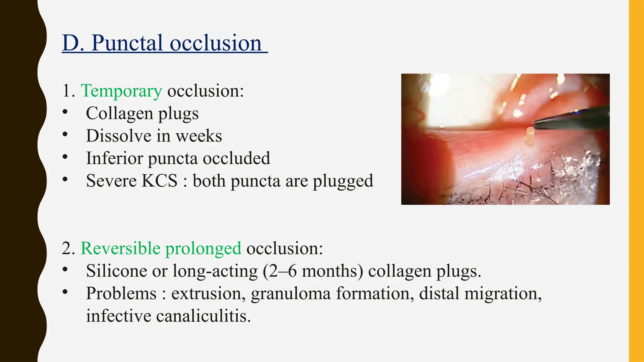 Dry Eye causes, aetiology, pathogenesis, treatment.pptx