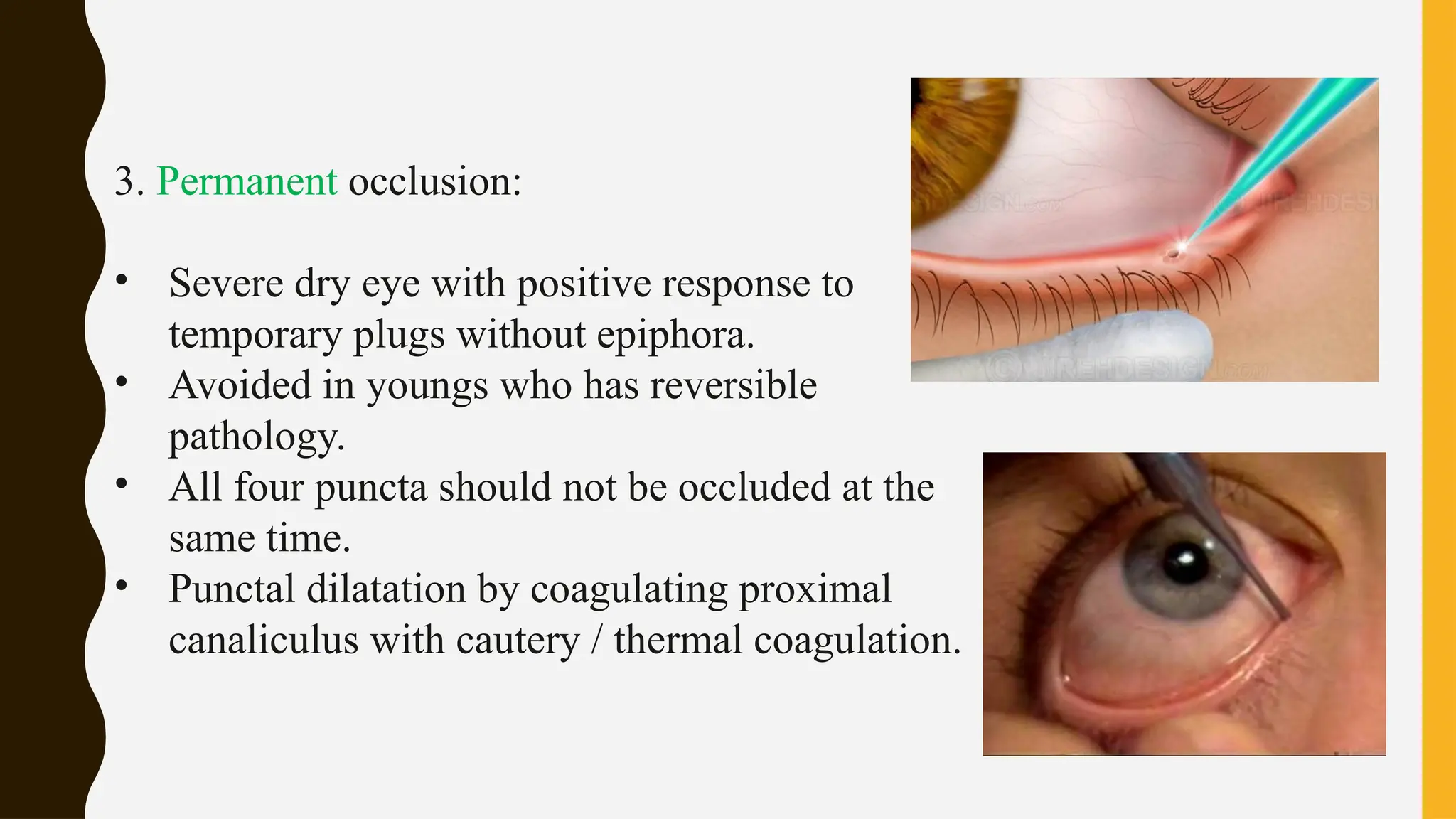 Dry Eye causes, aetiology, pathogenesis, treatment.pptx